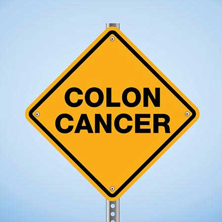 Risk Factors, Symptoms, and Treatments of Colorectal Cancer | Parkland ...