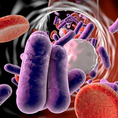 Understanding Sepsis | Parkland Medical Center